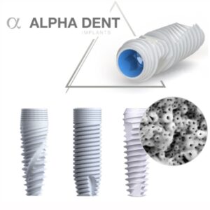 Implantation of teeth - DentalKnysh dentistry in Lviv